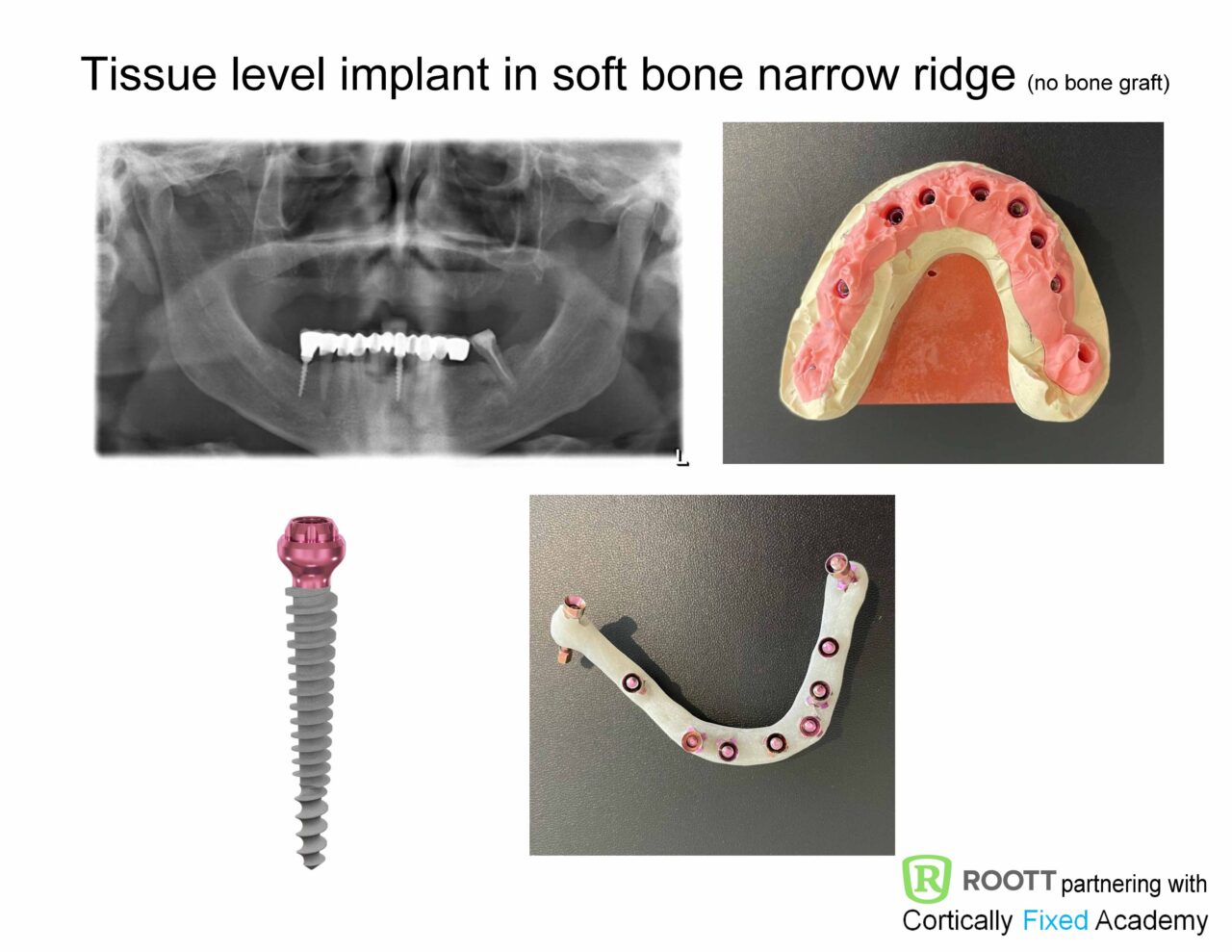Patient Cases - ROOTT