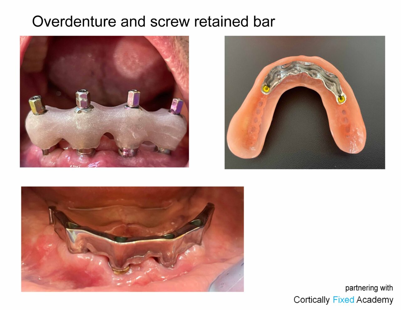 Patient Cases - ROOTT