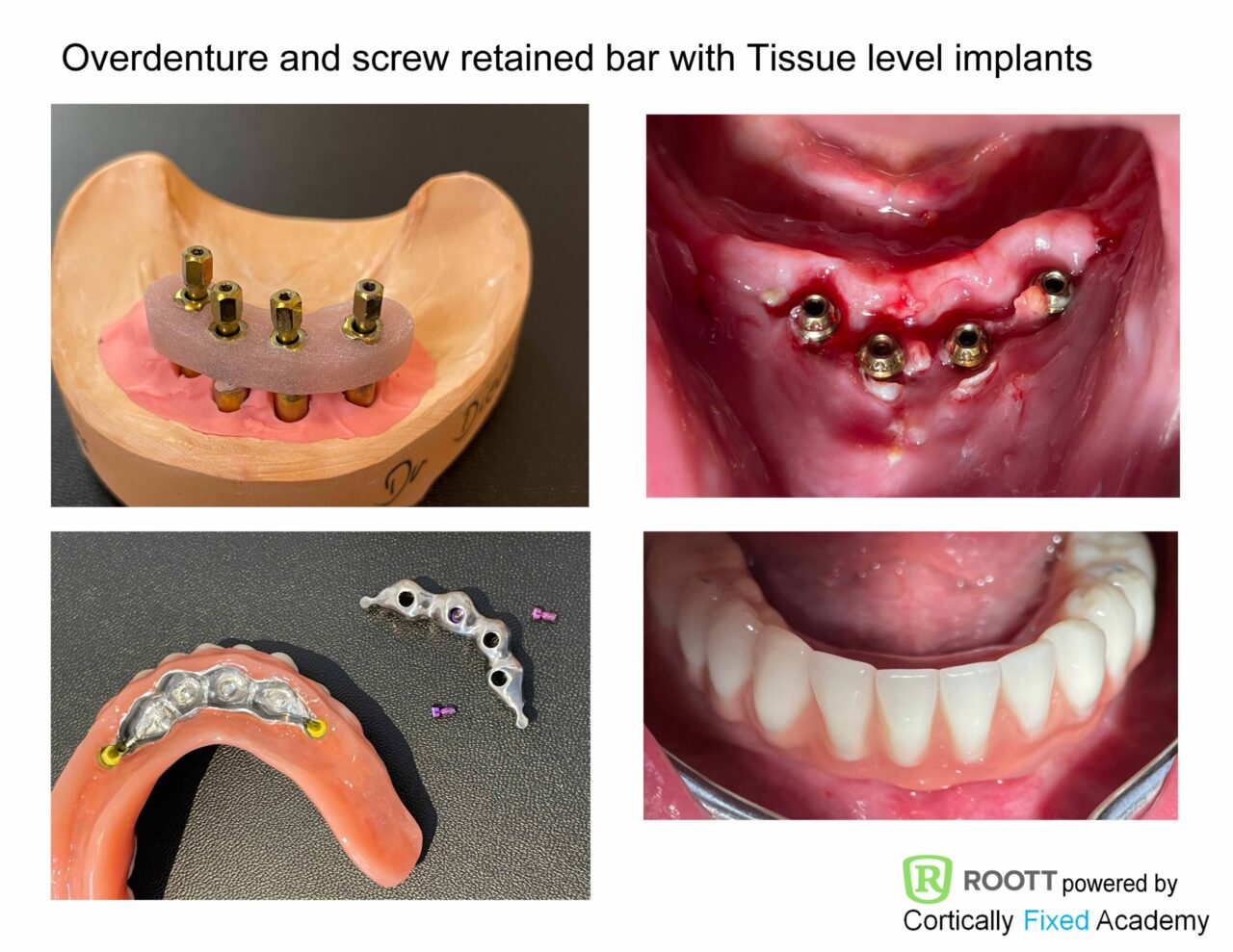 Patient Cases - ROOTT