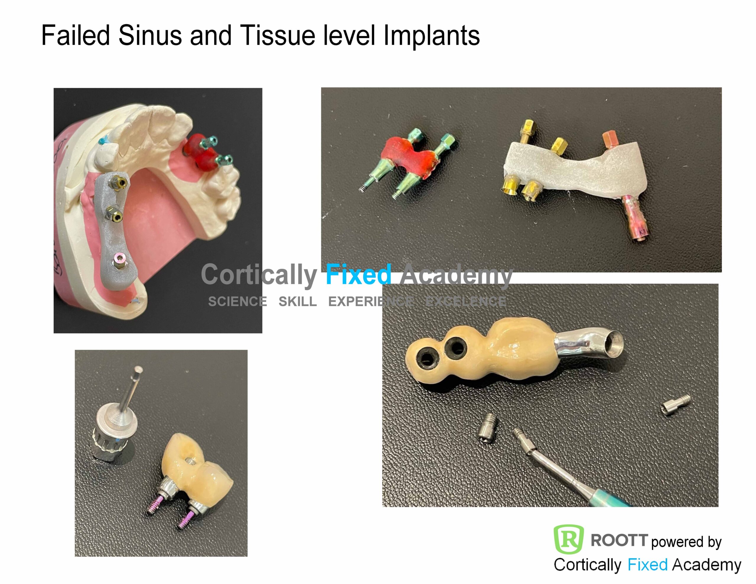 Patient Cases - ROOTT