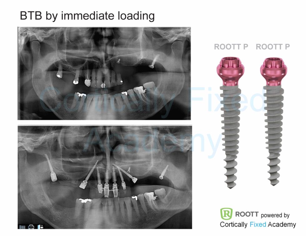Patient Cases - ROOTT