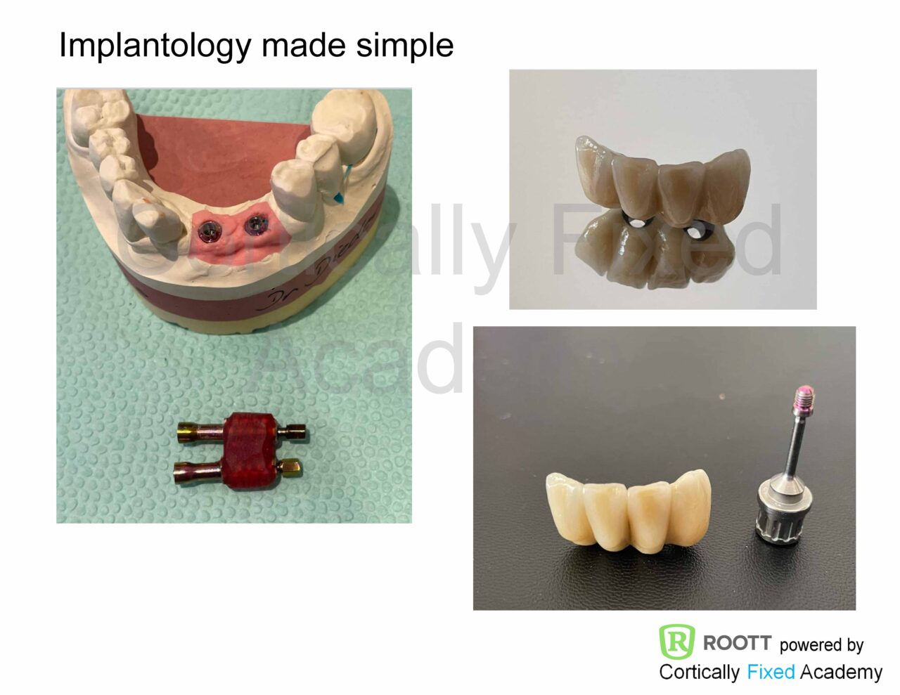 Case Reports - ROOTT