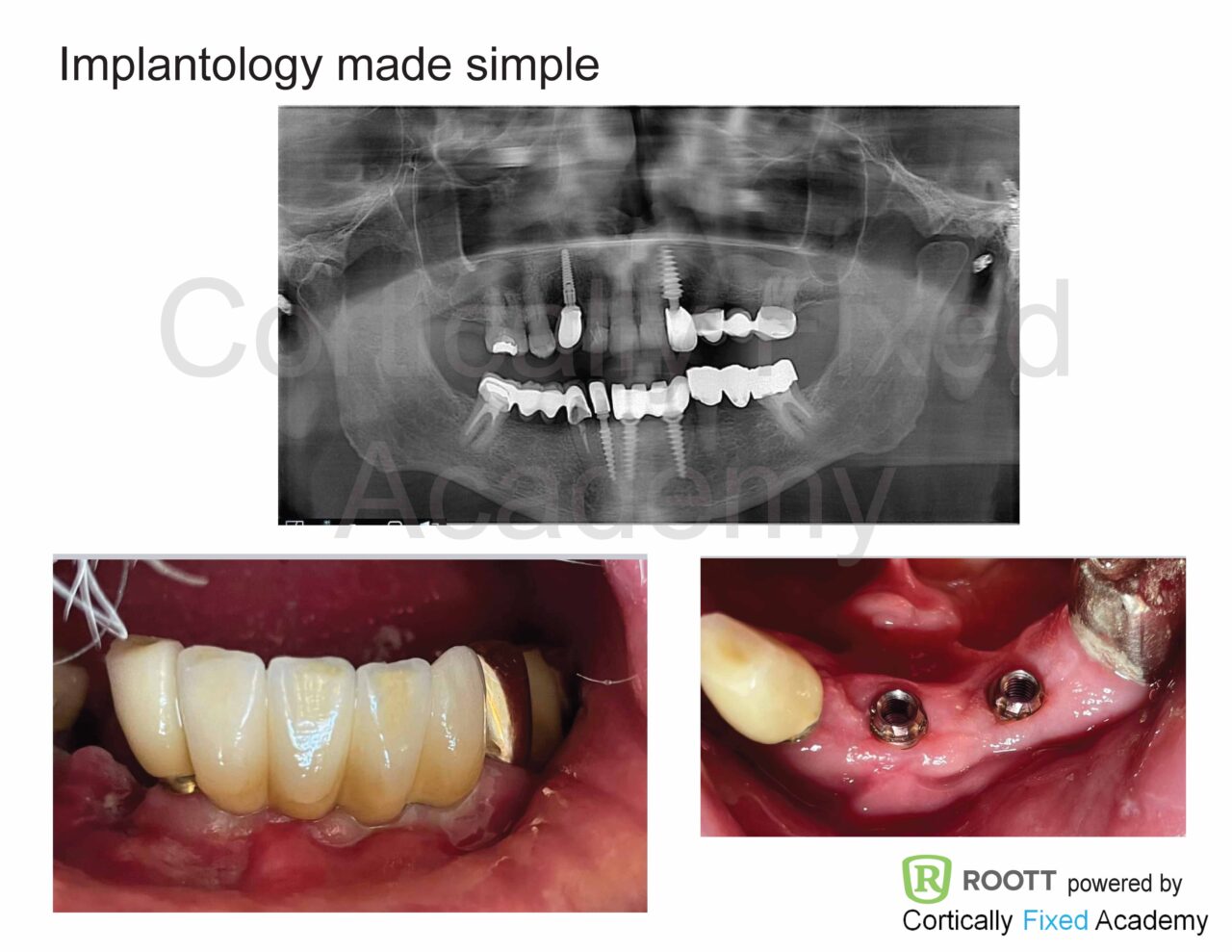 Case Reports - ROOTT
