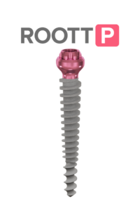 Implant Range - ROOTT